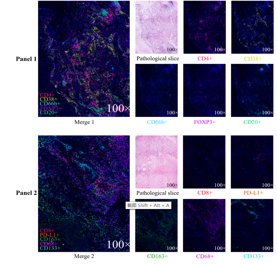 TSA-mIF for TIME Analysis-EnkiLife-Recombinant Proteins,Antibodies,Kits ...